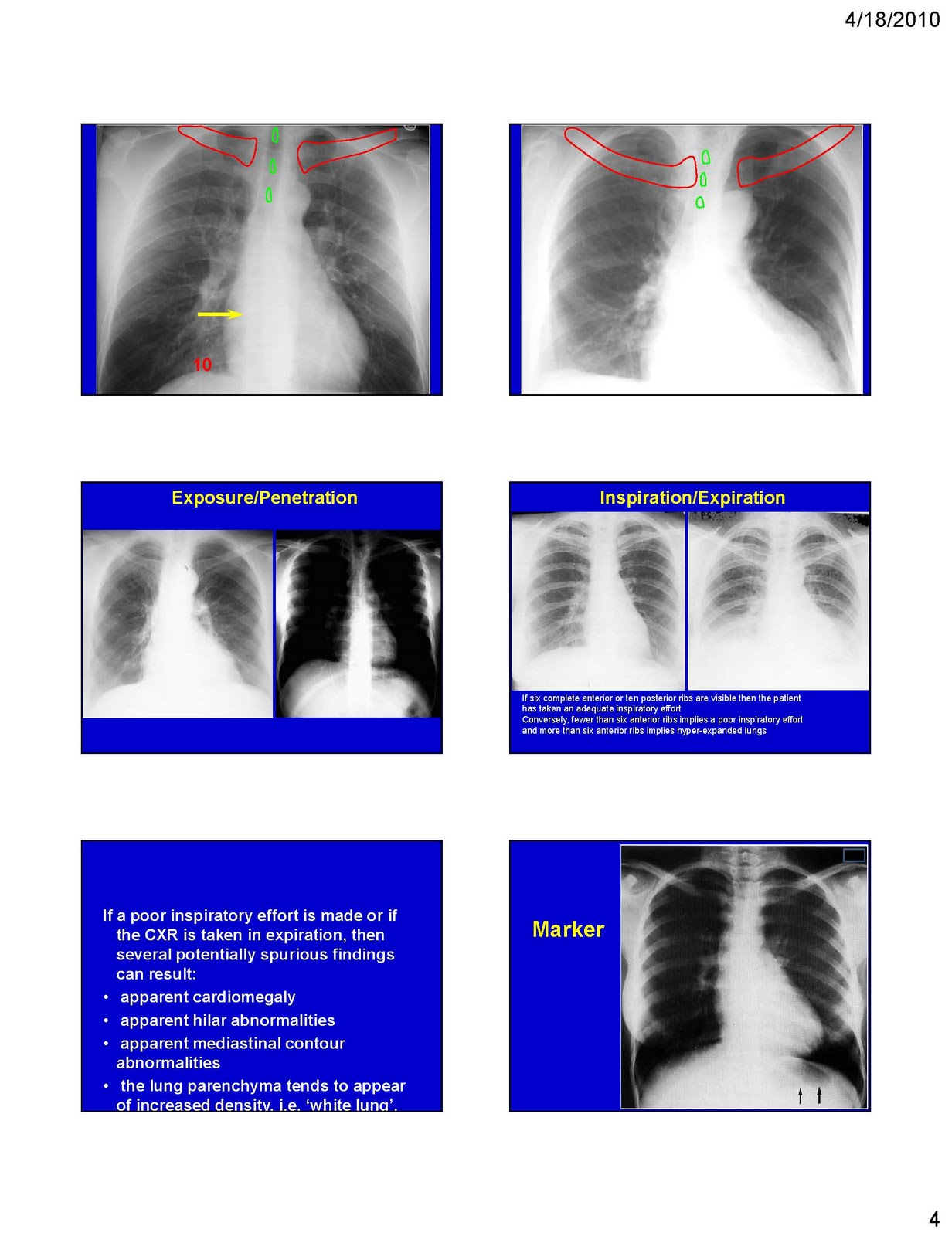 Respiratory Critical Care and Sleep Medicine: CHEST X-RAY ...